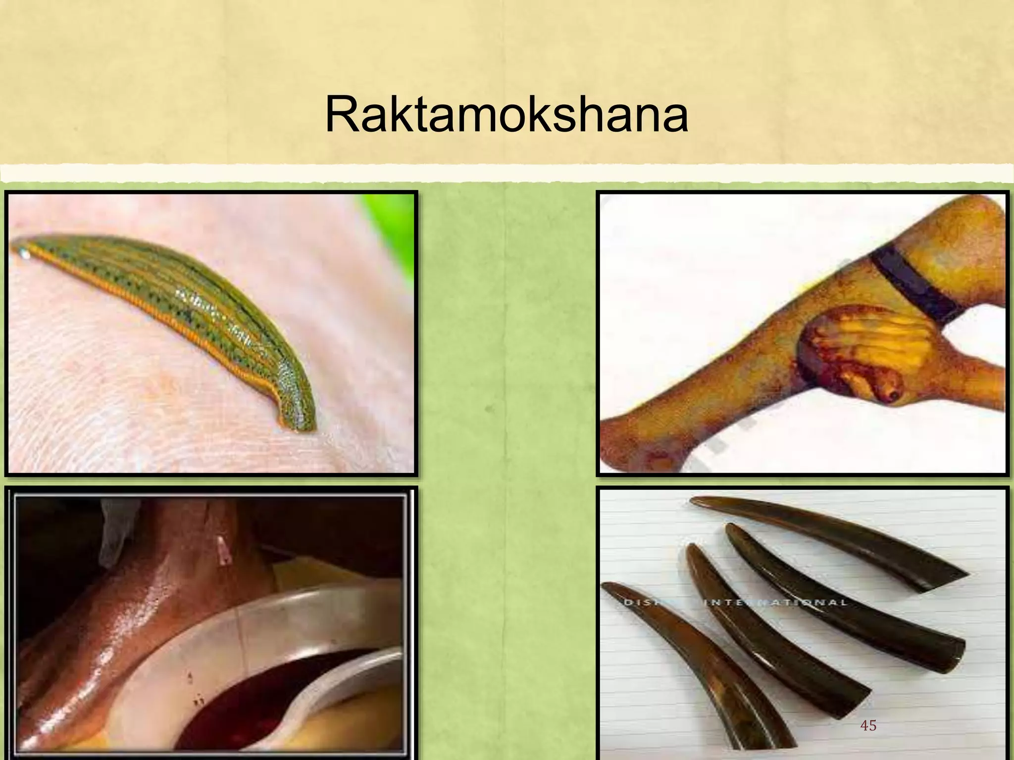 Panchakarma Instruments and its modifications | PPTX