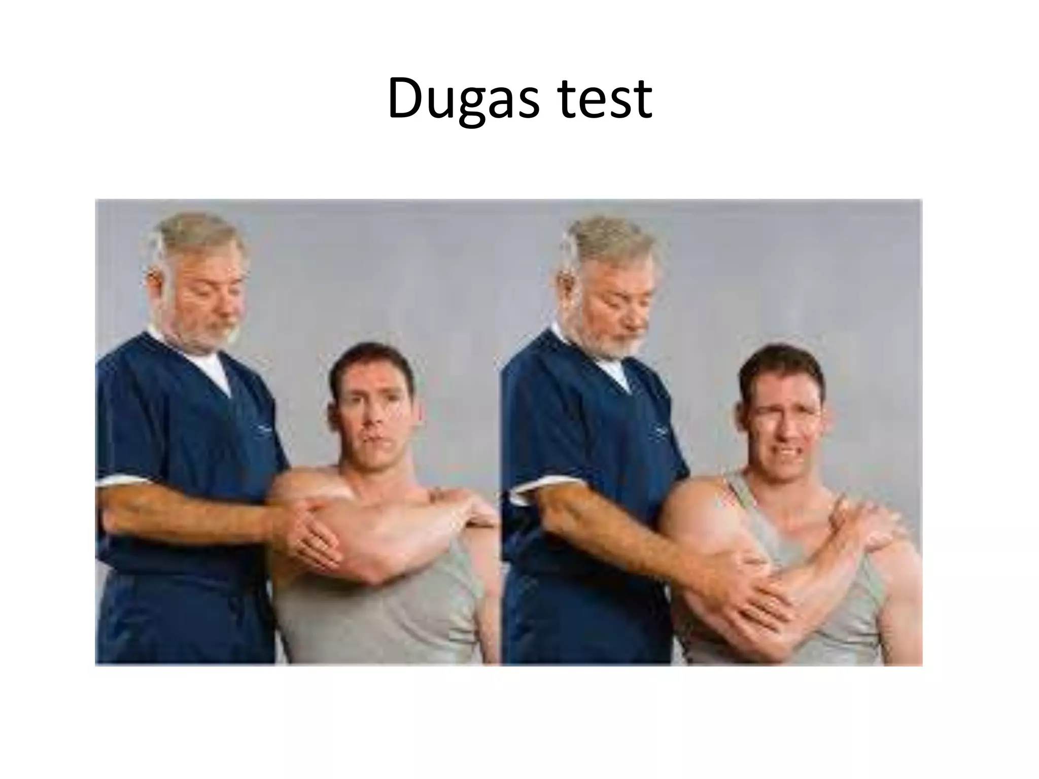 dislocations of shoulder dr.guru prasad | PPTX