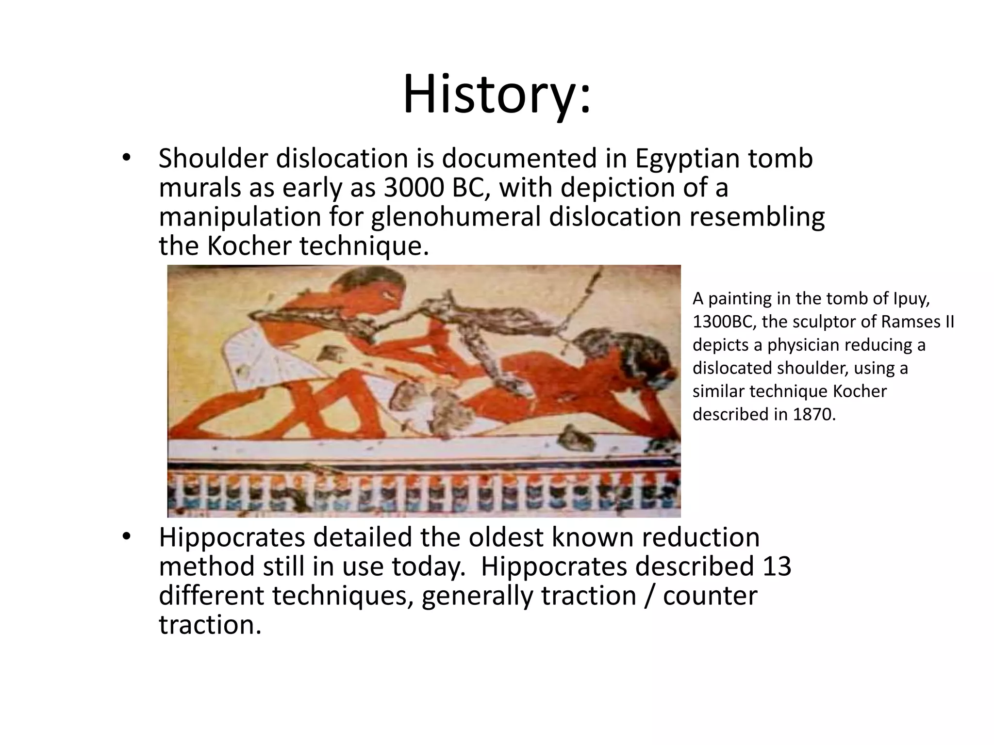 dislocations of shoulder dr.guru prasad | PPTX