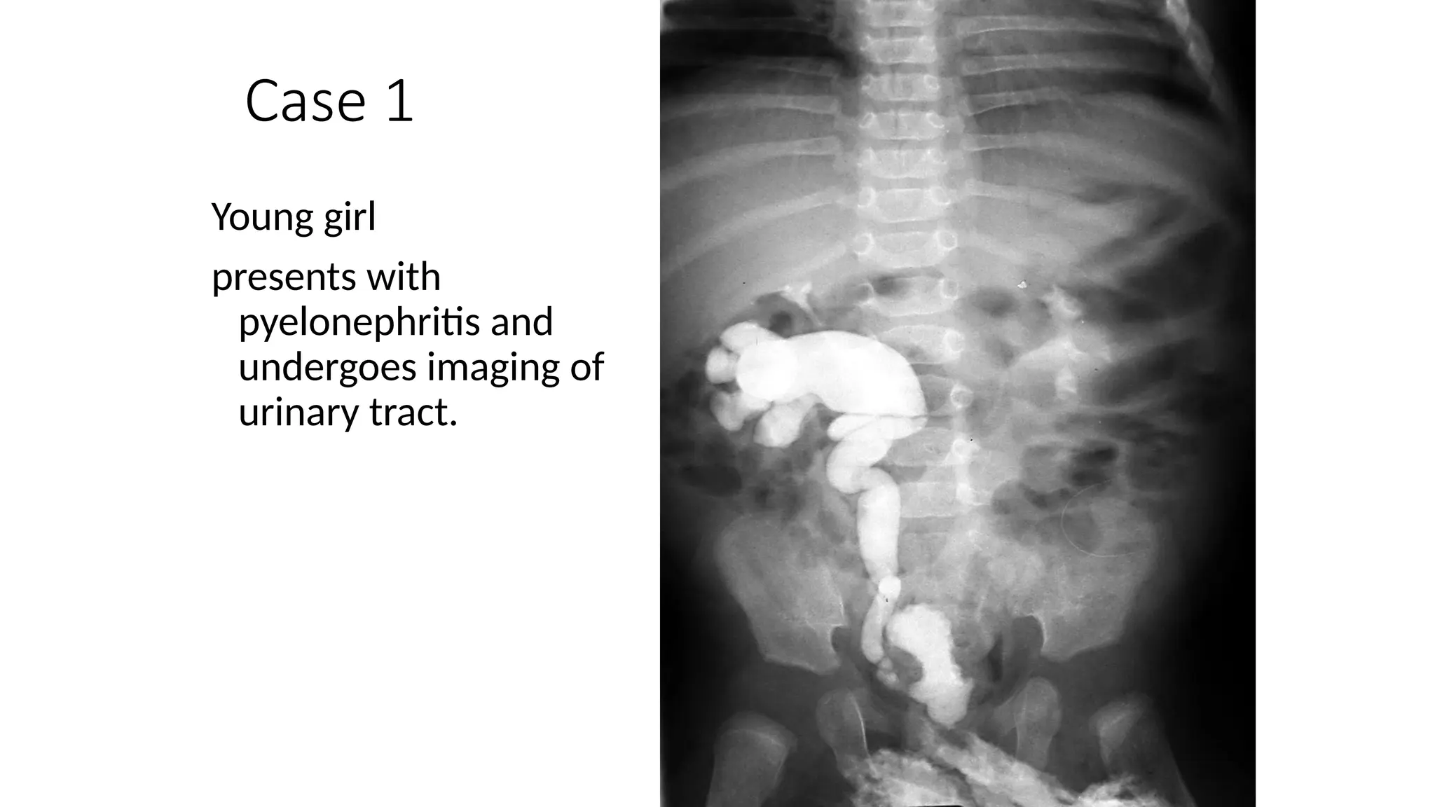Genito-Urinary System examination in children.pptx