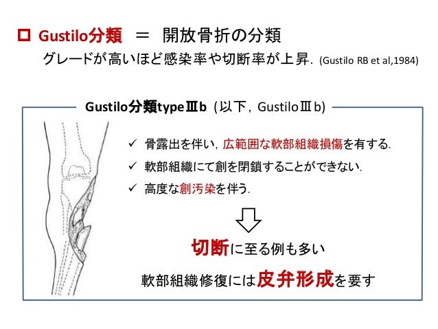 Gustilo分類typeⅢb下腿骨幹部開放骨折4例の機能成績