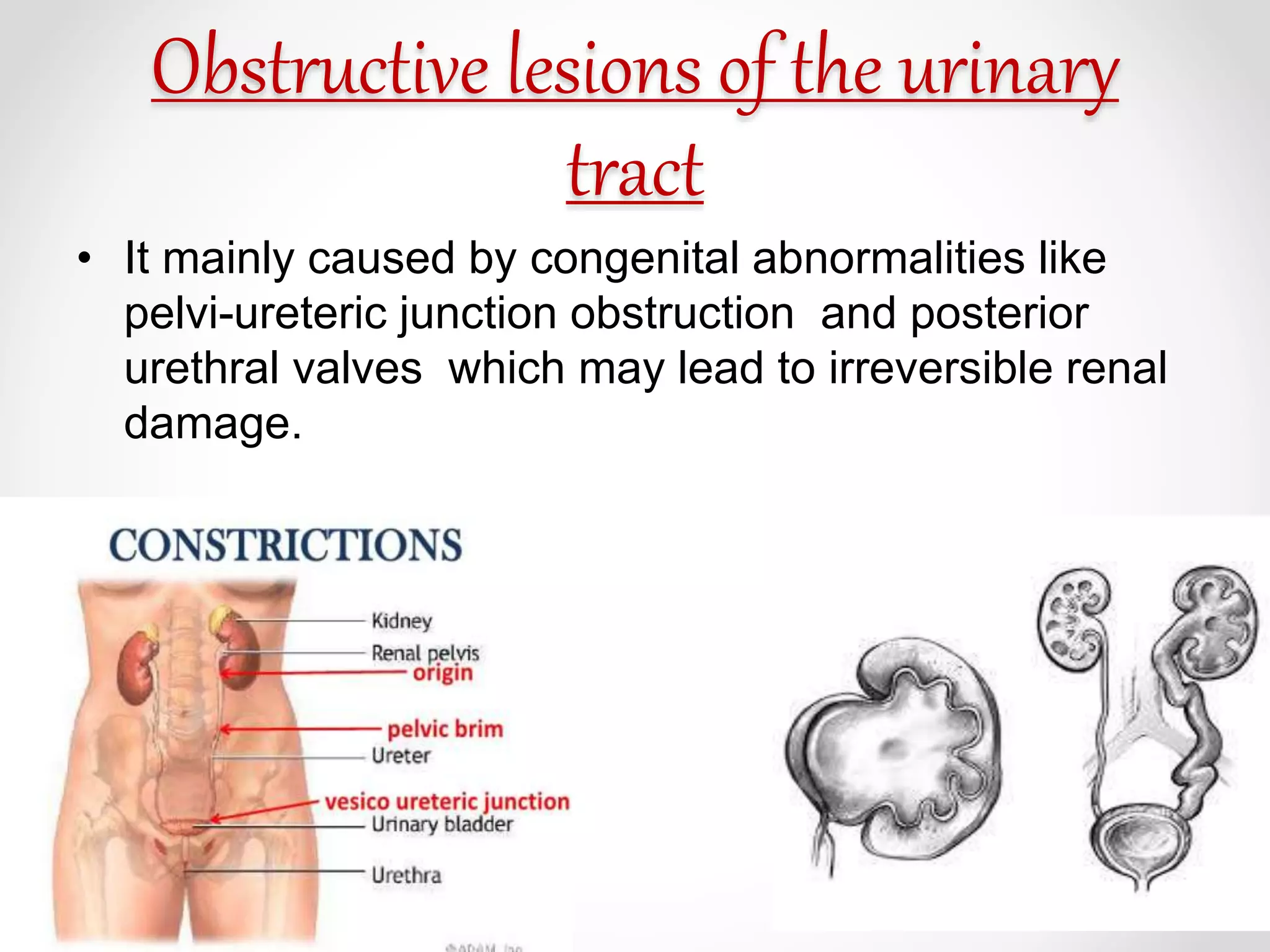Disorders of Gu system by Abhi | PPTX