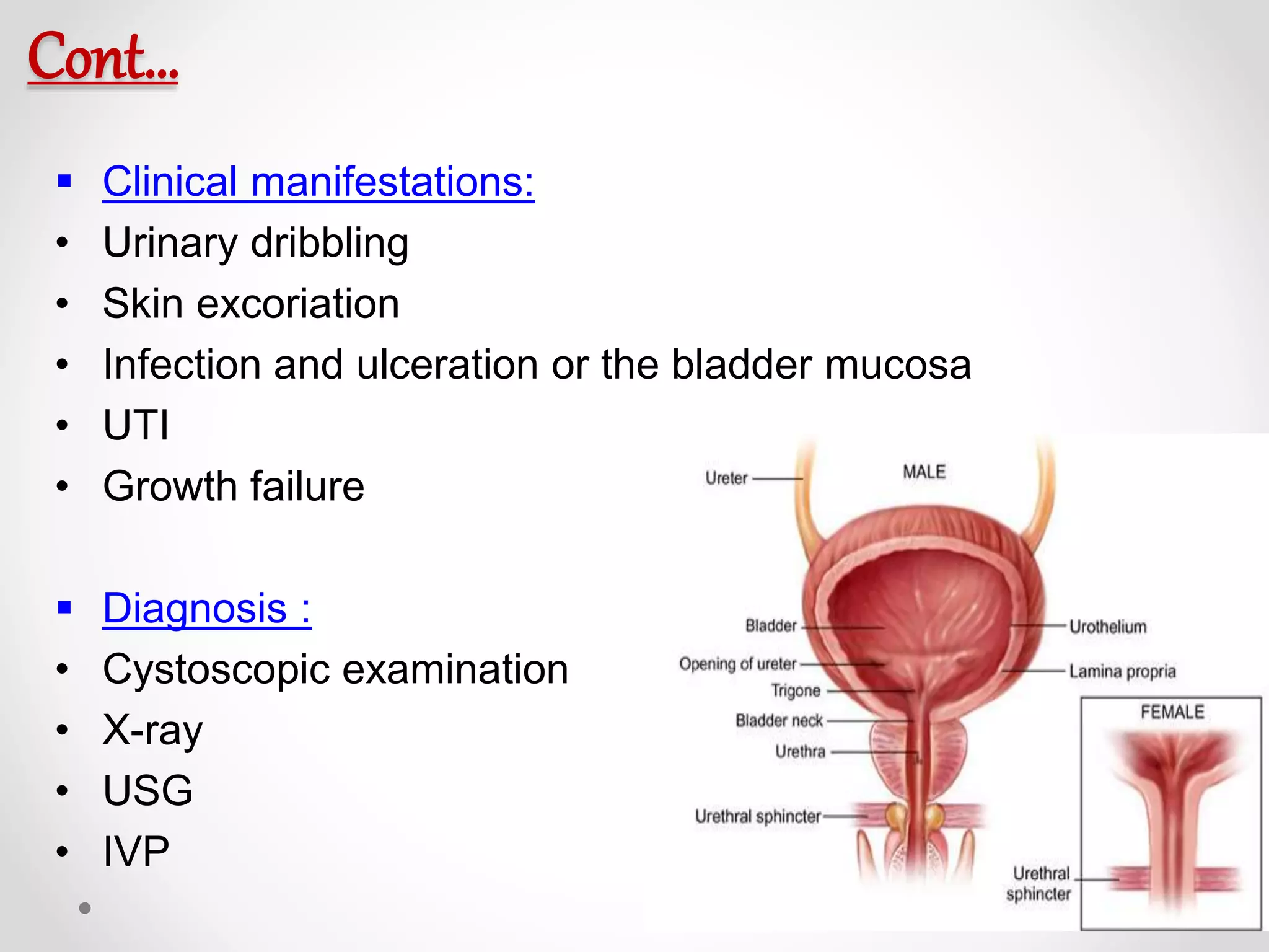 Disorders of Gu system by Abhi | PPTX | Digestive Disorders | Diseases ...