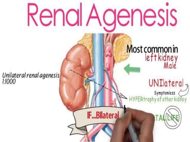 Disorders of Gu system by Abhi | PPTX | Digestive Disorders | Diseases ...
