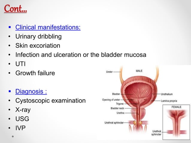 Disorders of Gu system by Abhi | PPTX | Digestive Disorders | Diseases ...