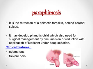 Disorders of Gu system by Abhi | PPT