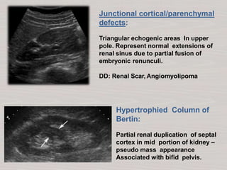 Junctional Parenchymal Defect
