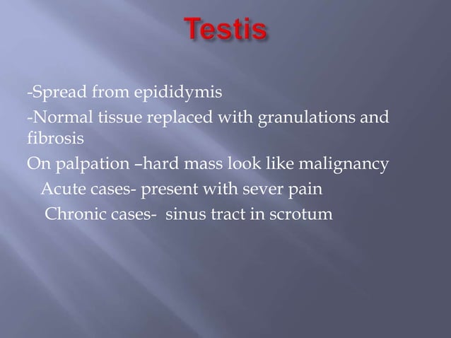 Genitourinary tuberculosis -2020 | PPTX | Digestive Disorders | Diseases and Conditions