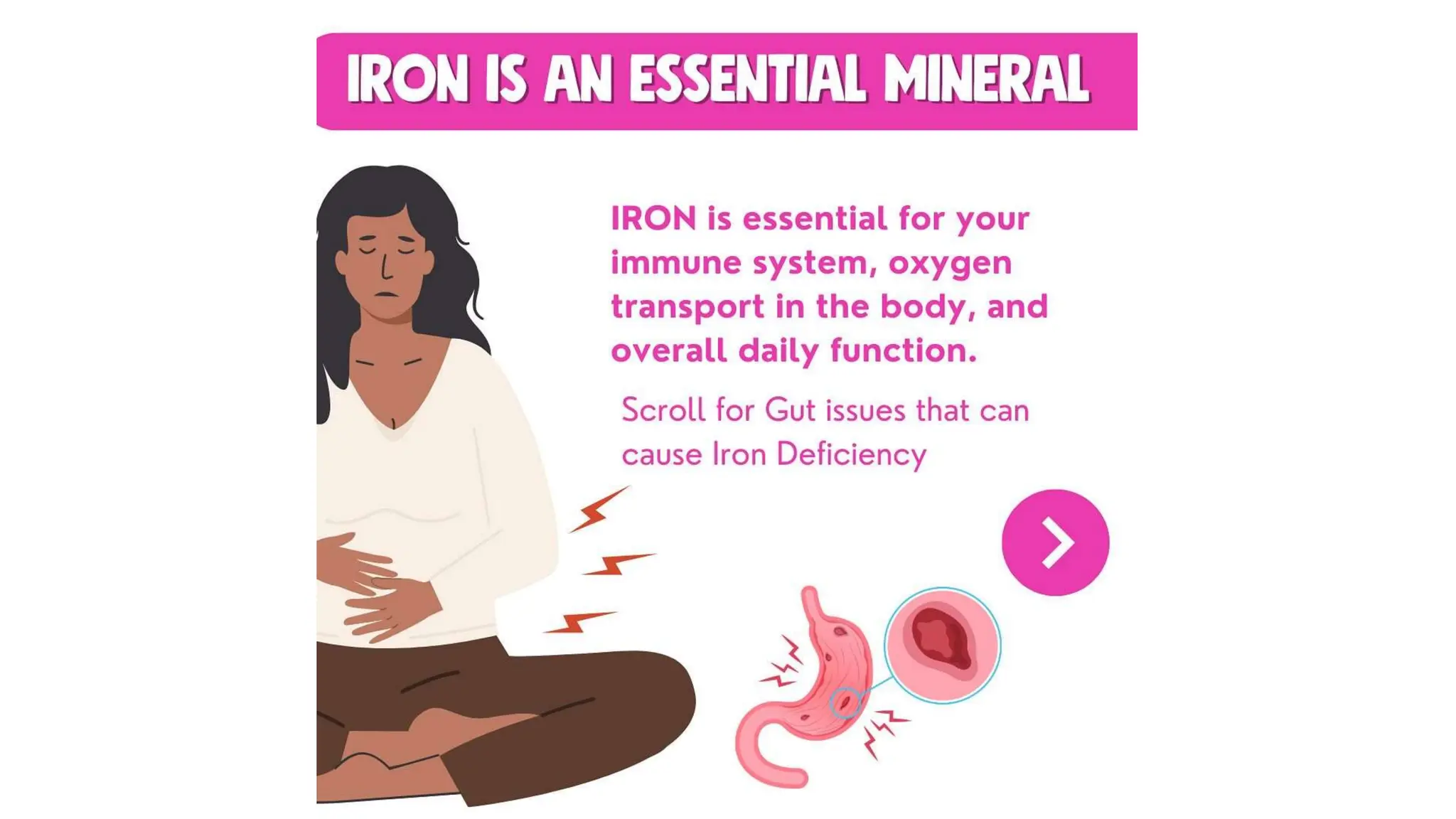 Gut health and Iron Deficiency - Nova Ferrum | PPTX