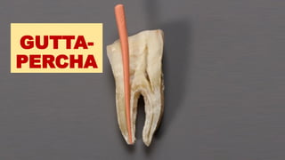 GUTTA PERCHA IN ENDODONTICS, INTRODUCTION, TYPES, ALPHA, BETA , USES ...