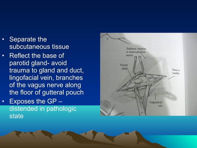 Gutteral pouches, By Dr. Rekha Pathak, senior scientist IVRI | PPT