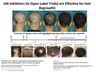 Cytokine Targeted Therapeutics: Lessons from Atopic Dermatitis and ...