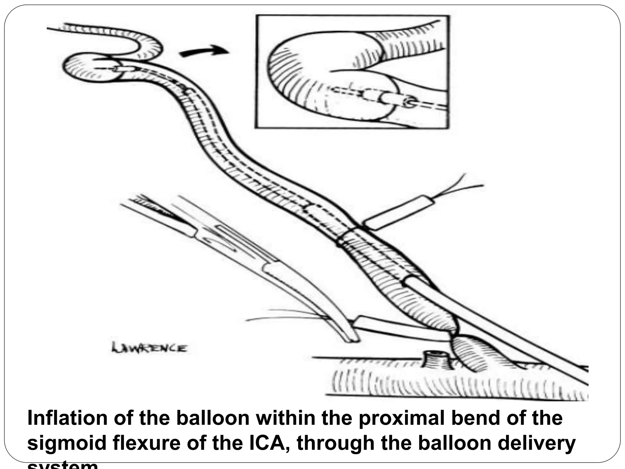 Guttural pouch mycosis | PPTX