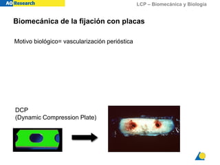 Biomecánica de la placa LCP | PDF