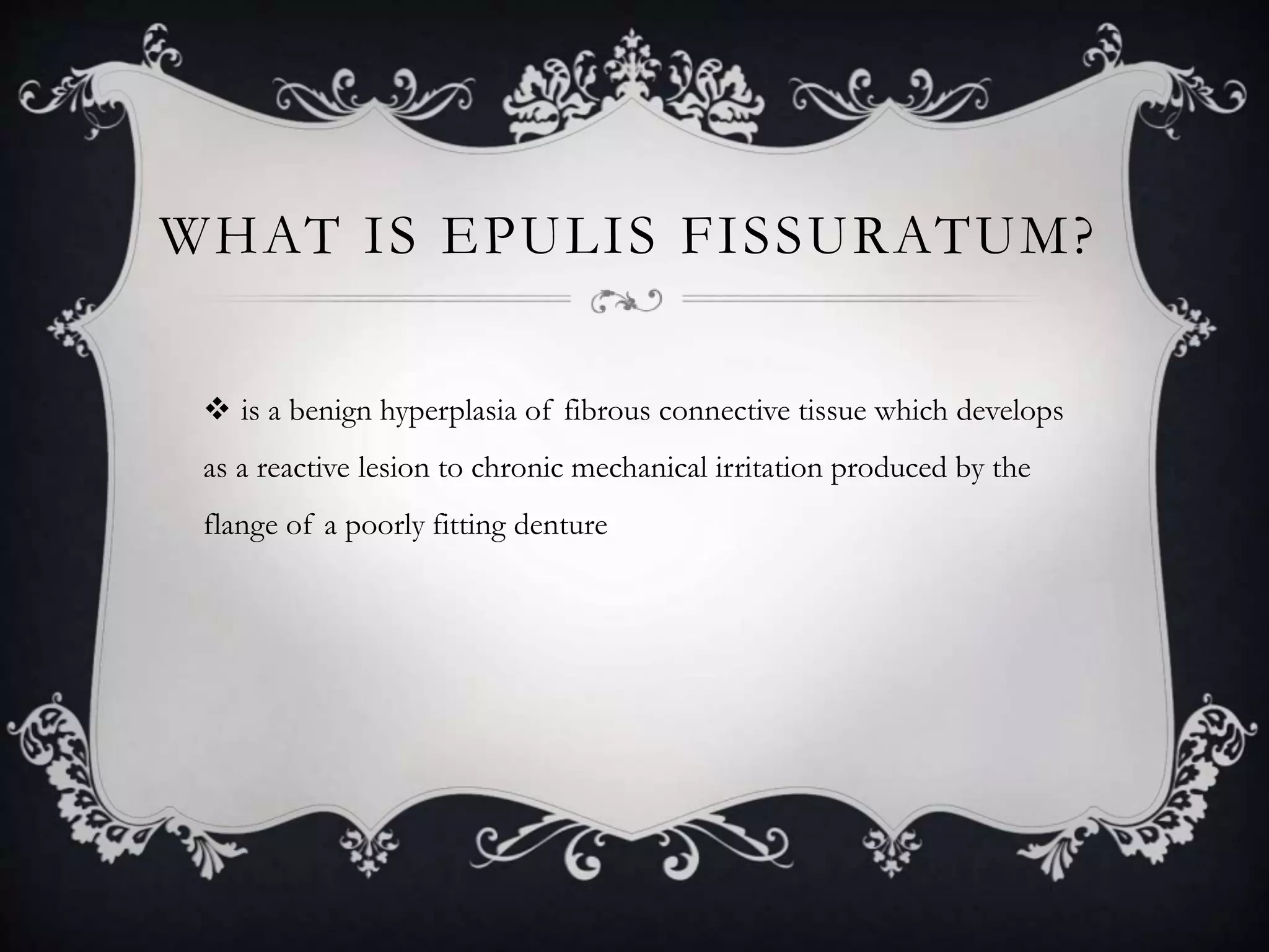 epulis fissuratum | PPTX
