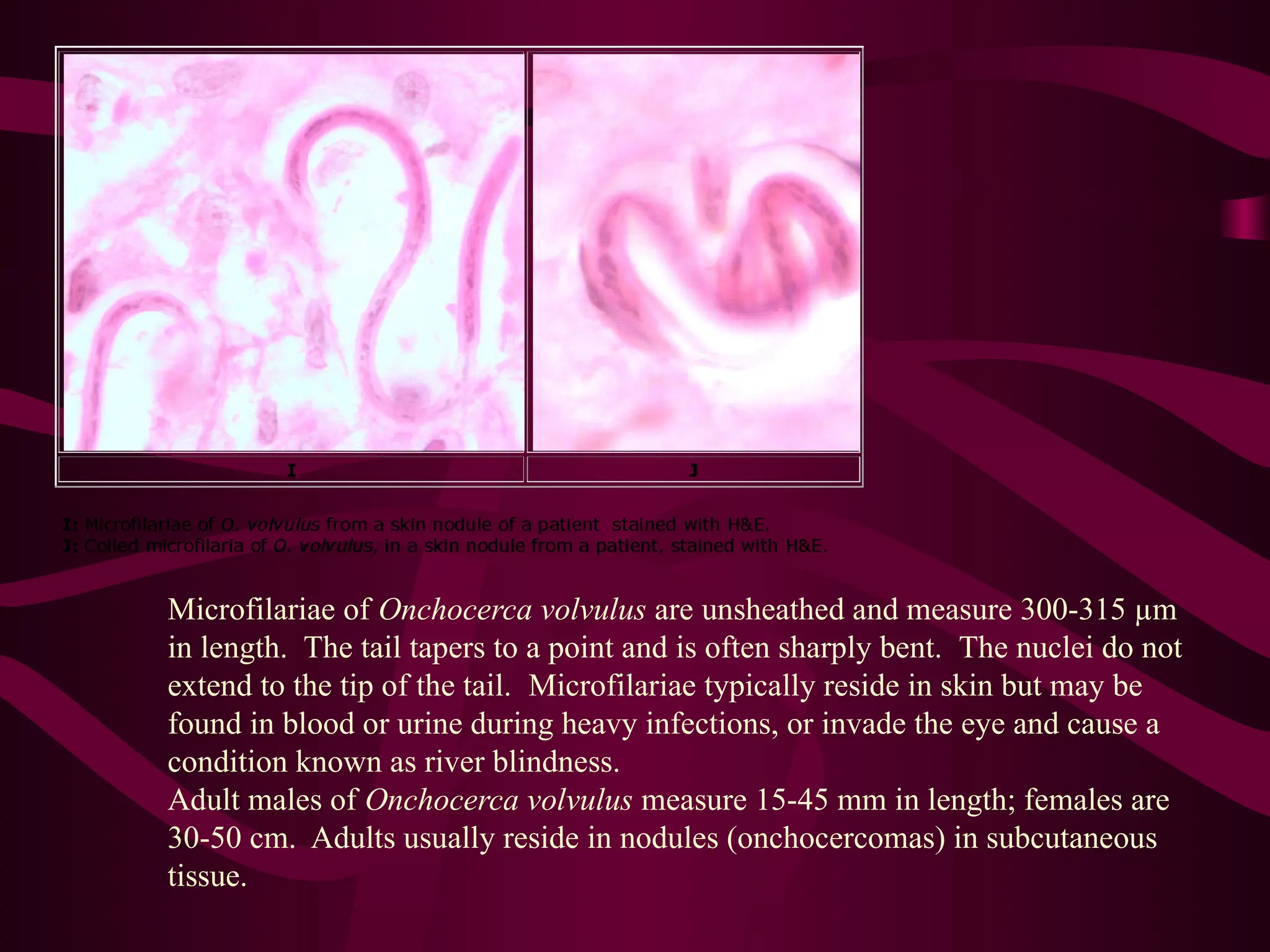 18. ONCHOCERCA VOLVULUs power point presentation | PPTX