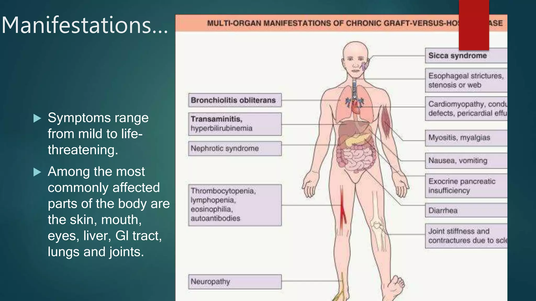 GVHD.pptx