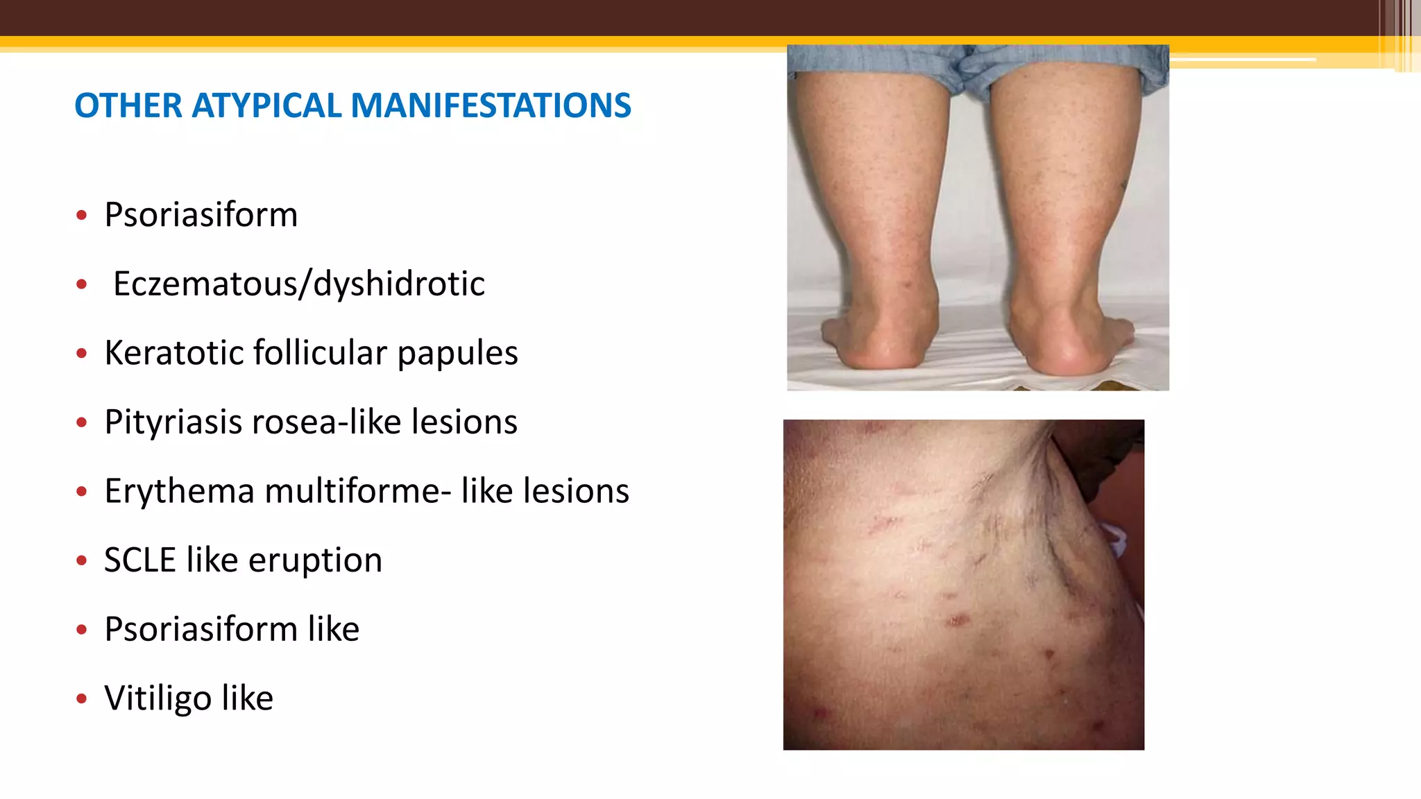 GVHD - tutorial.pptx