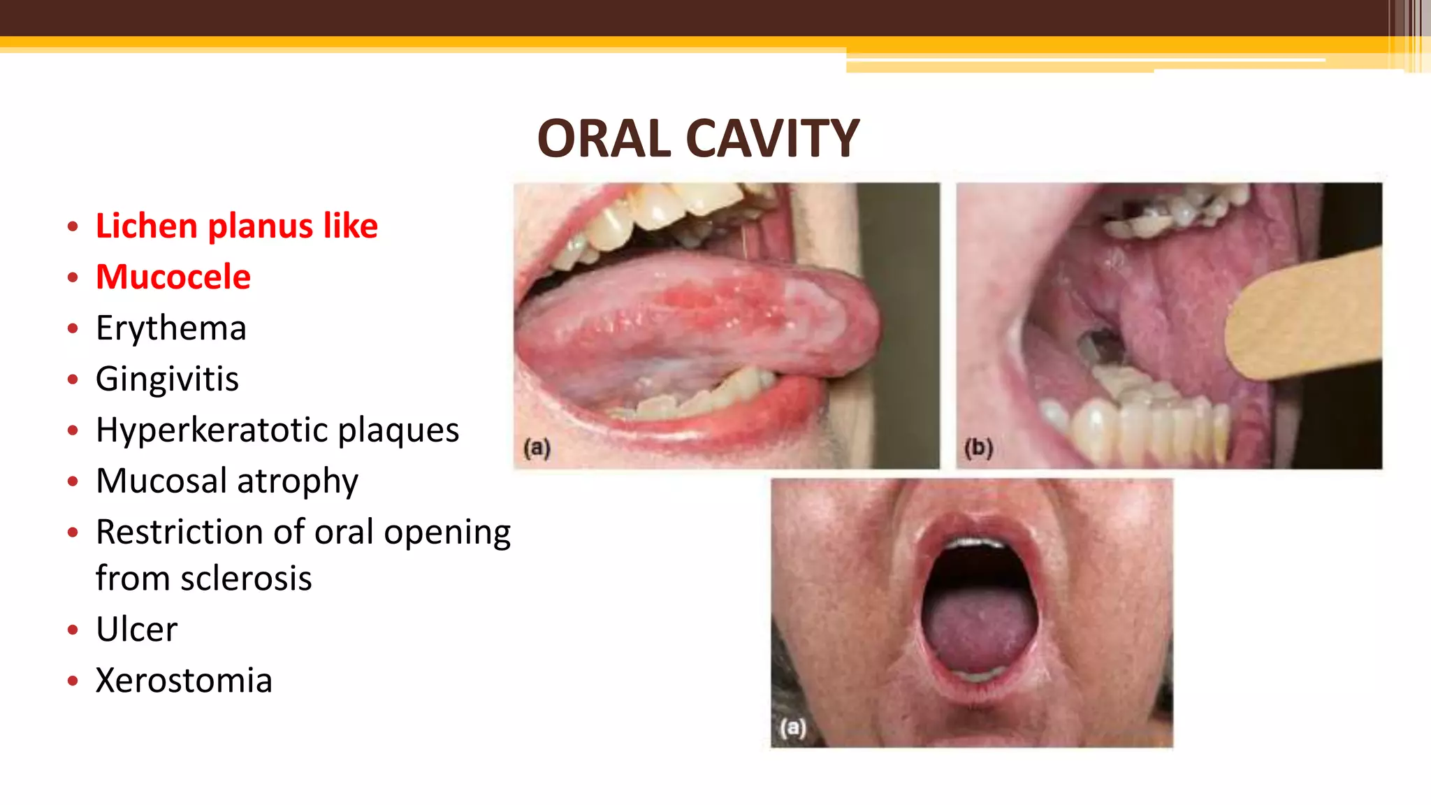 GVHD - tutorial.pptx