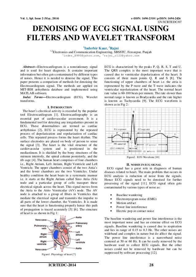 Denoising Of Ecg Signal Using Filters And Wavelet Transform