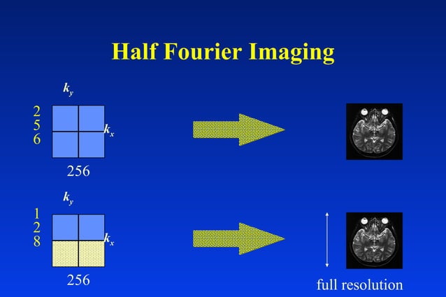Spatial encoding part_2 | PPT | Digital Audio | Computer Software and ...