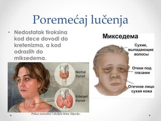 Štitasta zlezda | PPTX