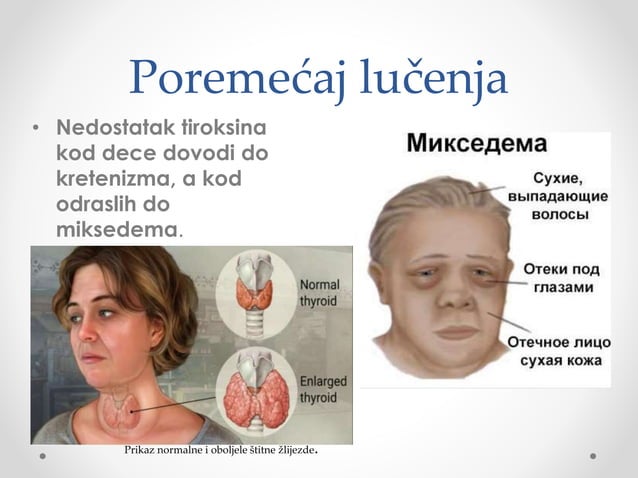 Štitasta zlezda | PPT