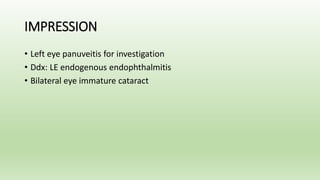 GWR LE panuveitis.pptx