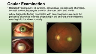 GWR LE panuveitis.pptx