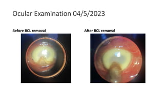 GWR TRAUMA.pptx