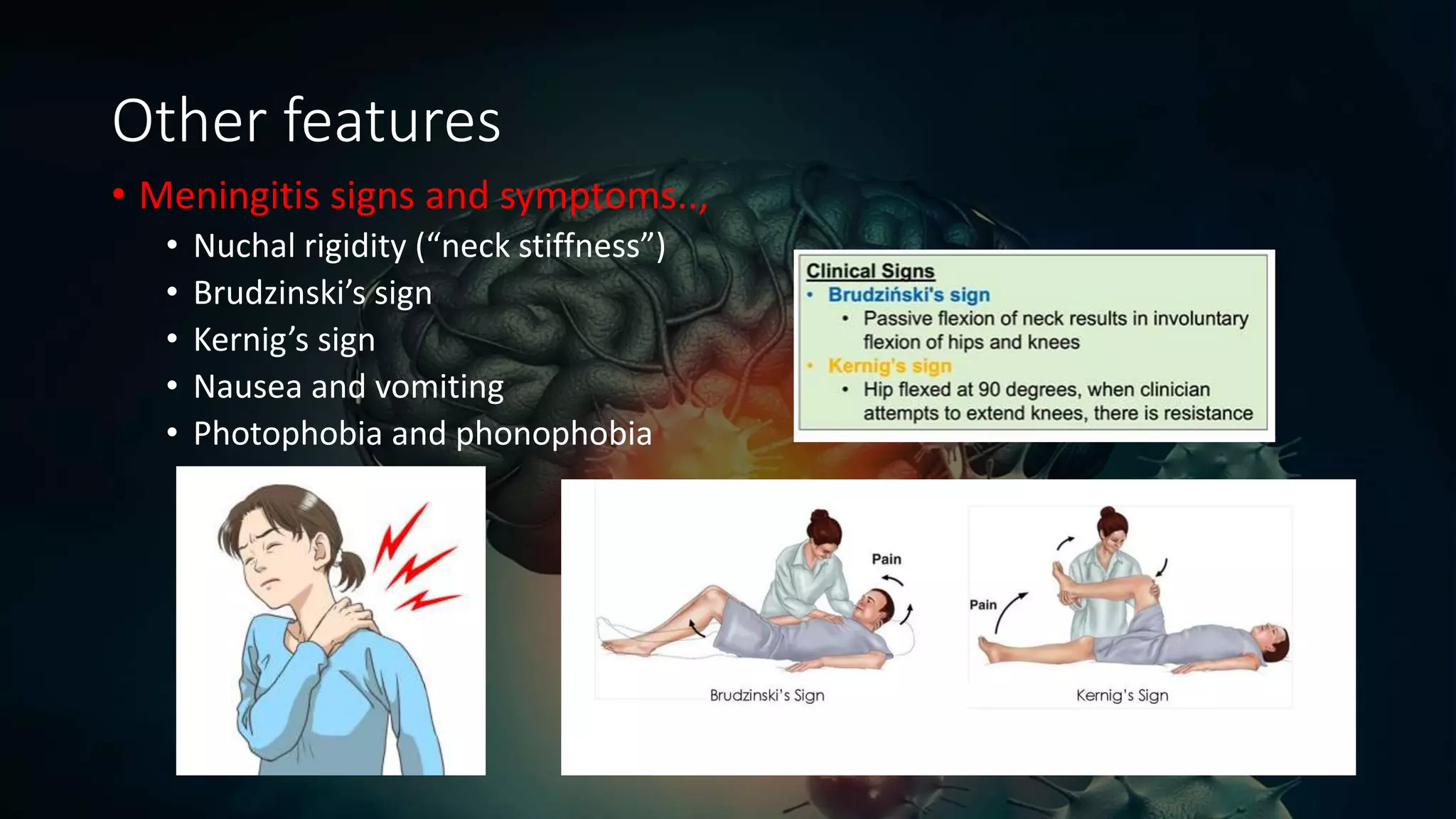 Encephalitis | PPTX