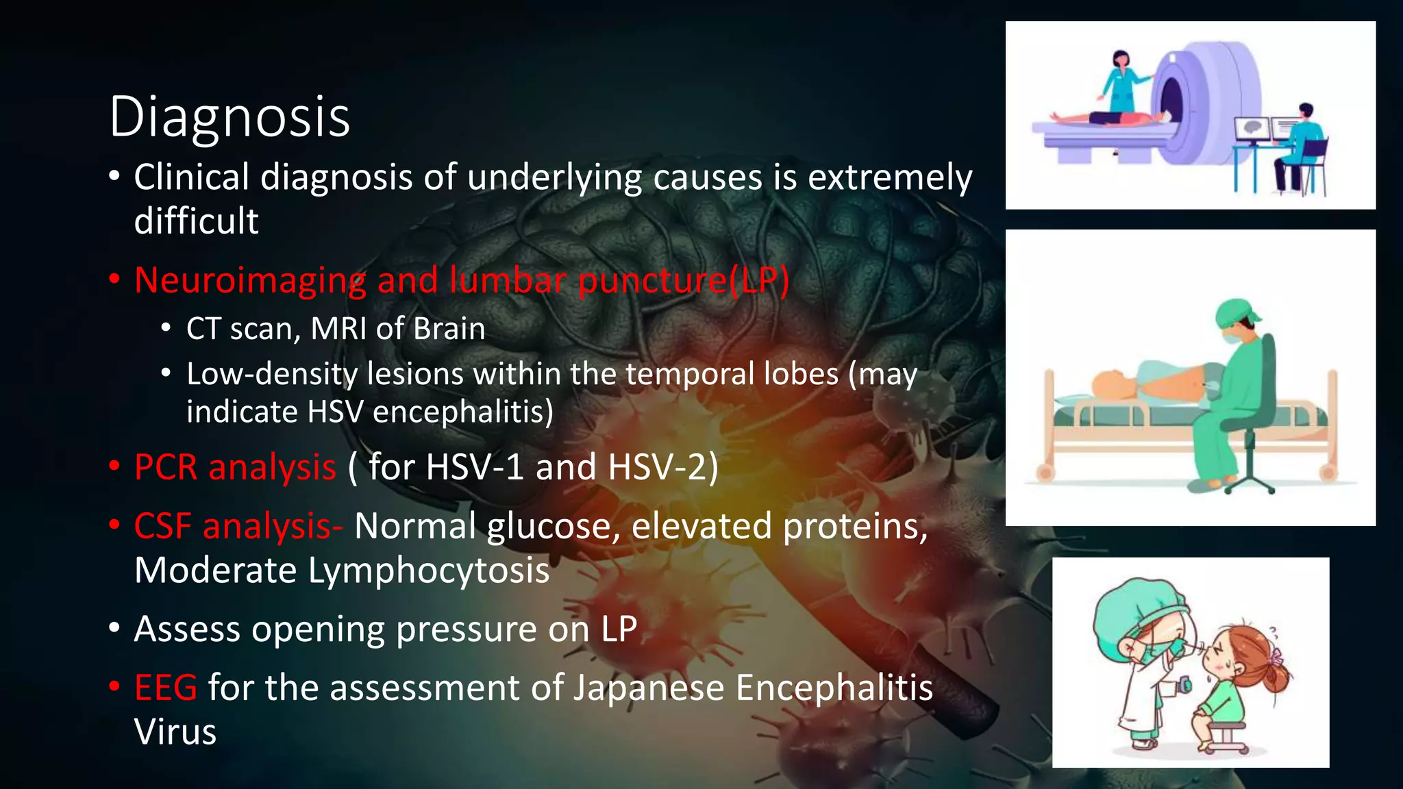 Encephalitis | PPTX