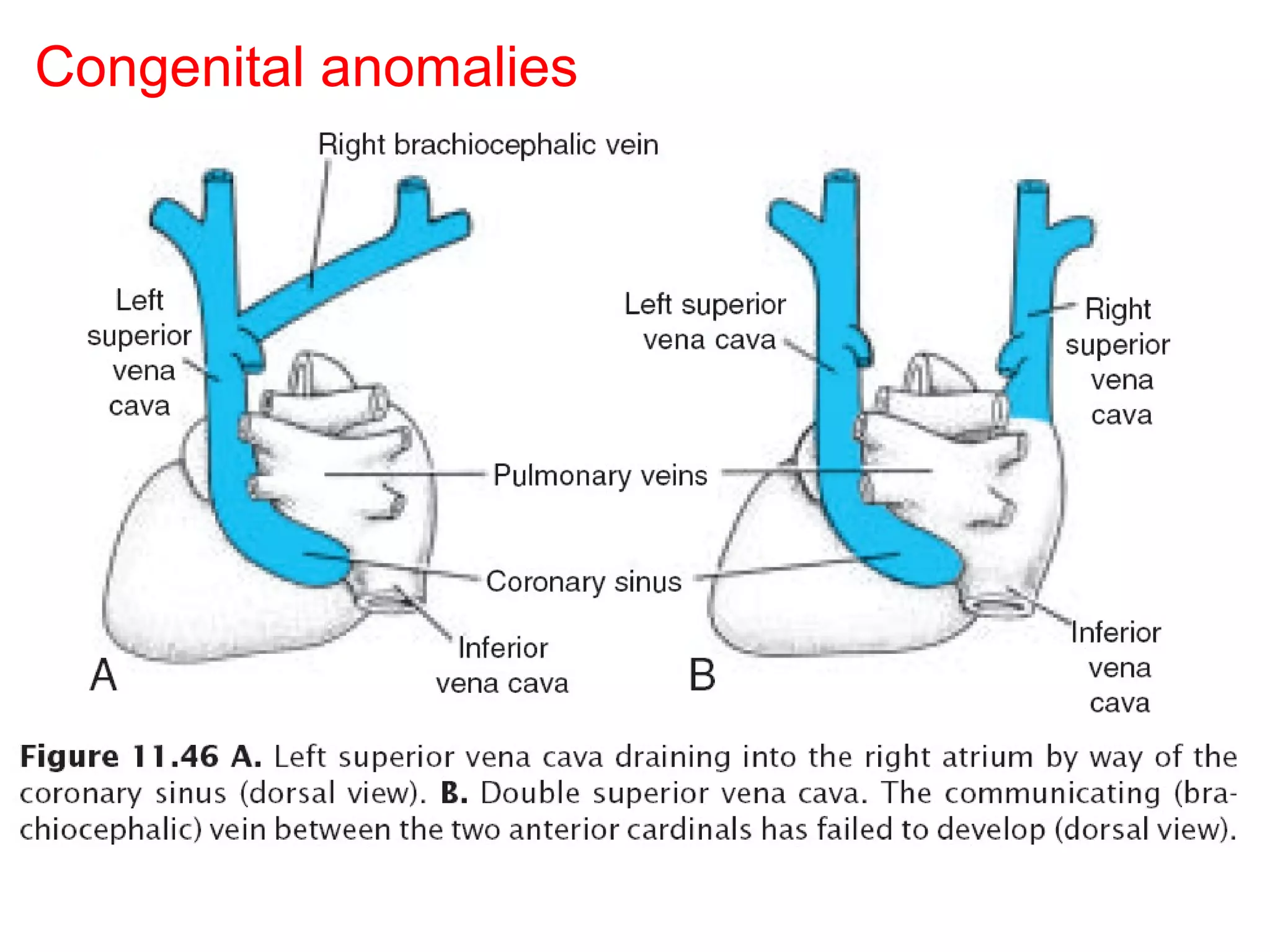 Development of veins | PPT