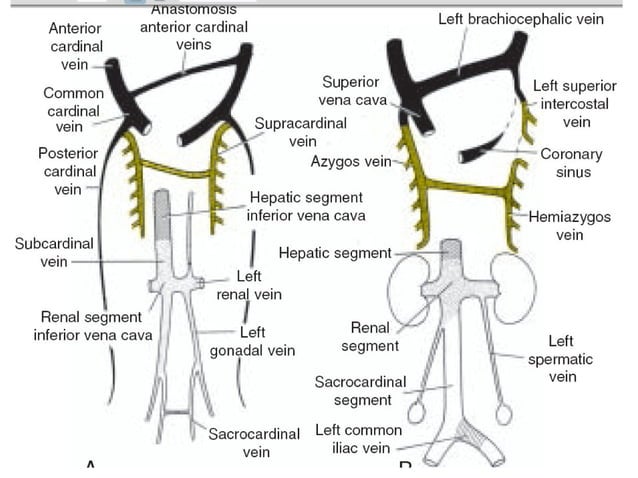 Development of veins | PPT | Heart and Cardiovascular Diseases ...