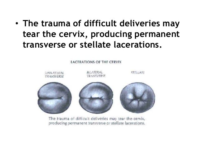 Gyaenocological examination 2