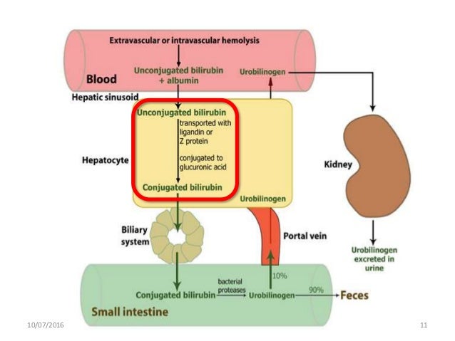 Physiological Neonatal Jaundice