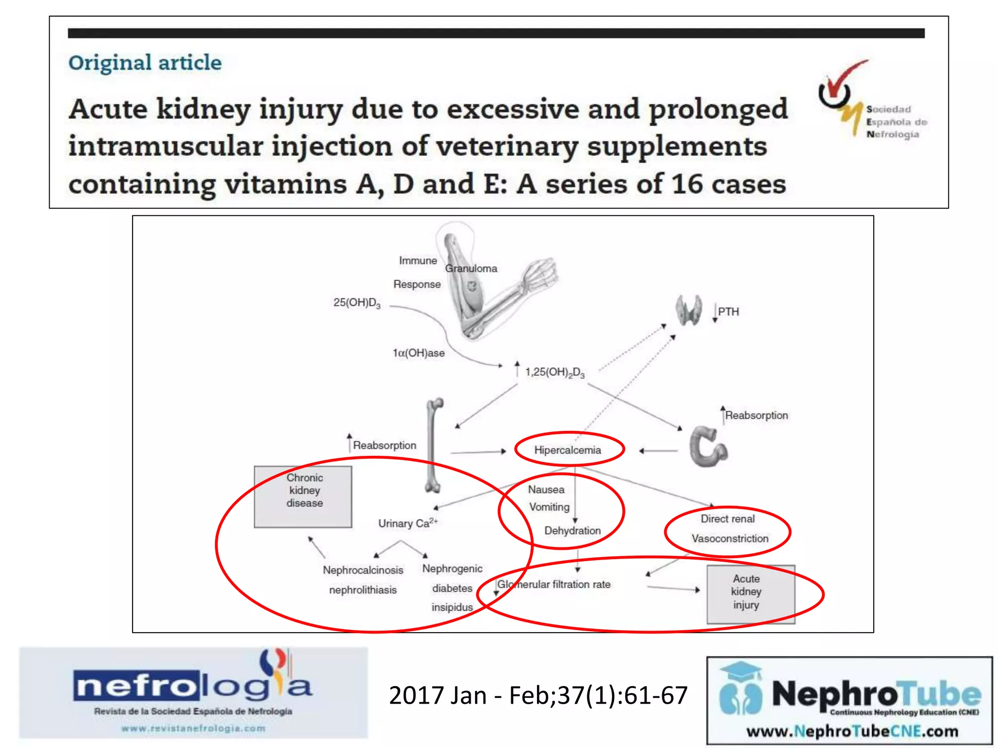 Gym nephropathy (bodybuilding vs. kidney damaging) - Dr. Gawad | PPTX