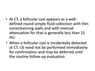 Gynacological causes of acute abdomen | PPTX