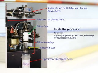 SIP slides on CYTO - gynae | PPTX