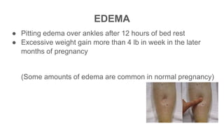 Gynae- pre eclampsia gynecology obstetrics final prof mbbs.pptx