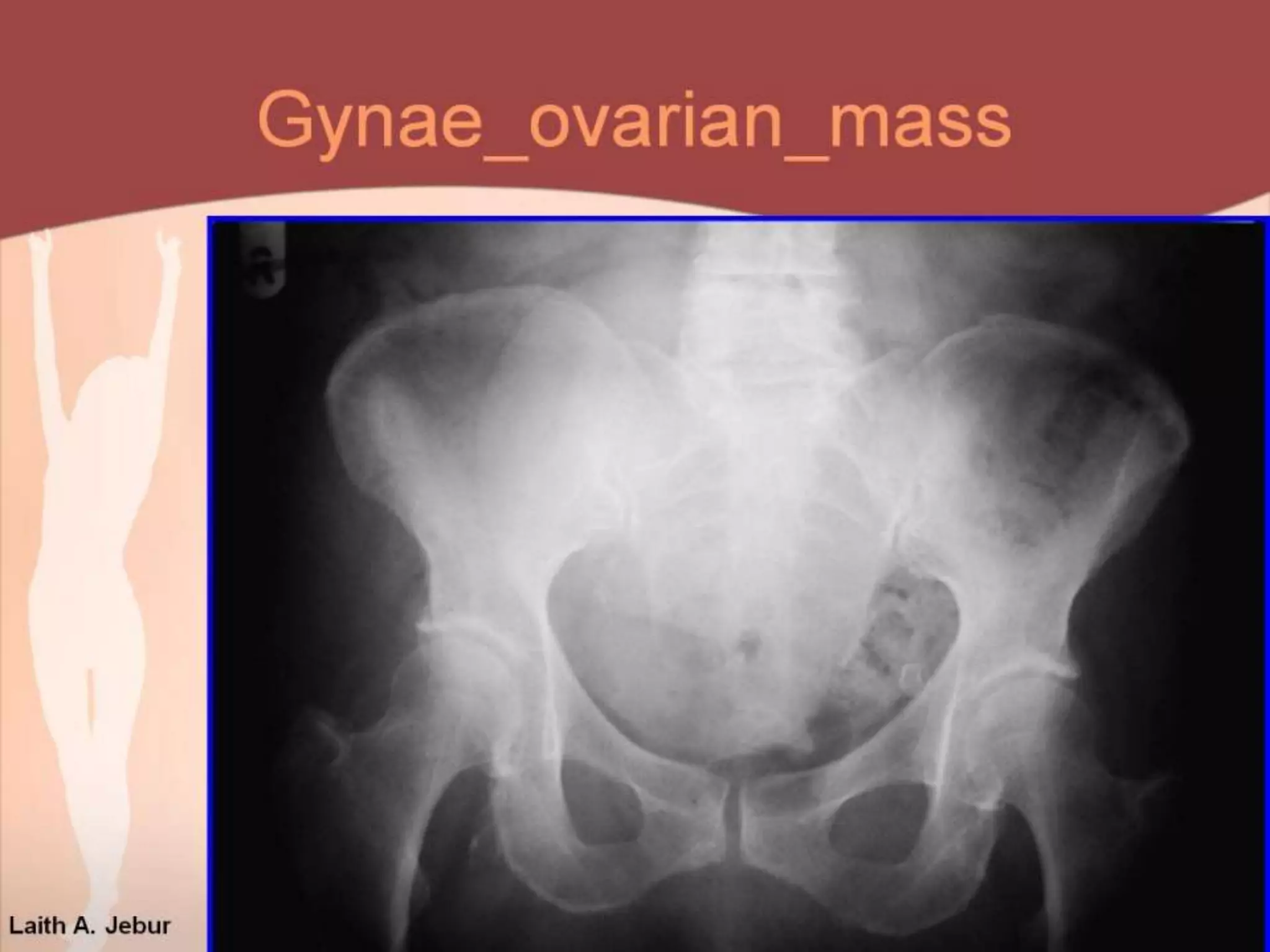 imaging of Gynaecology and obstetrics | PPSX