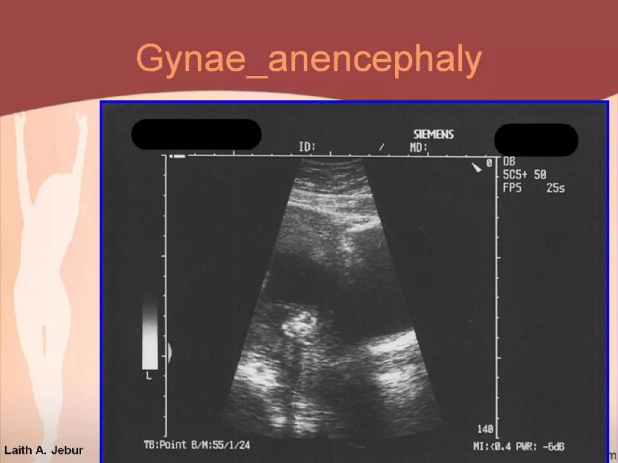 imaging of Gynaecology and obstetrics | PPSX