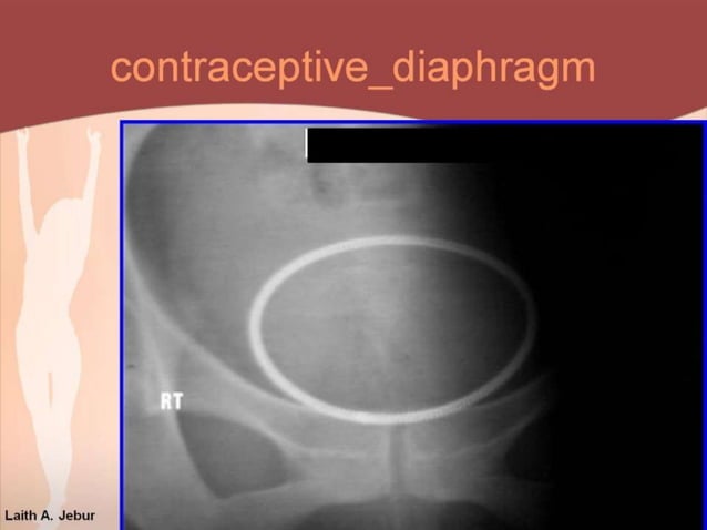 imaging of Gynaecology and obstetrics | PPSX