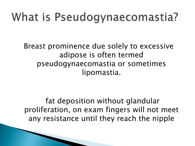 Gynaecomastia | PPTX