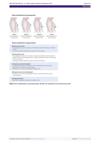 Gynaecomastia | PDF