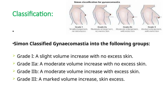 GYNAECOMASTIA male reproductive system.pptx