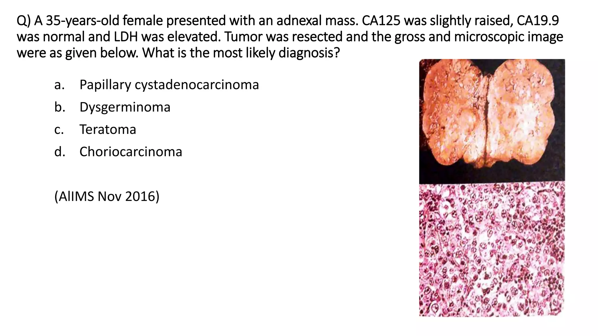 GYNAE PATH INTEGRATED.pptx