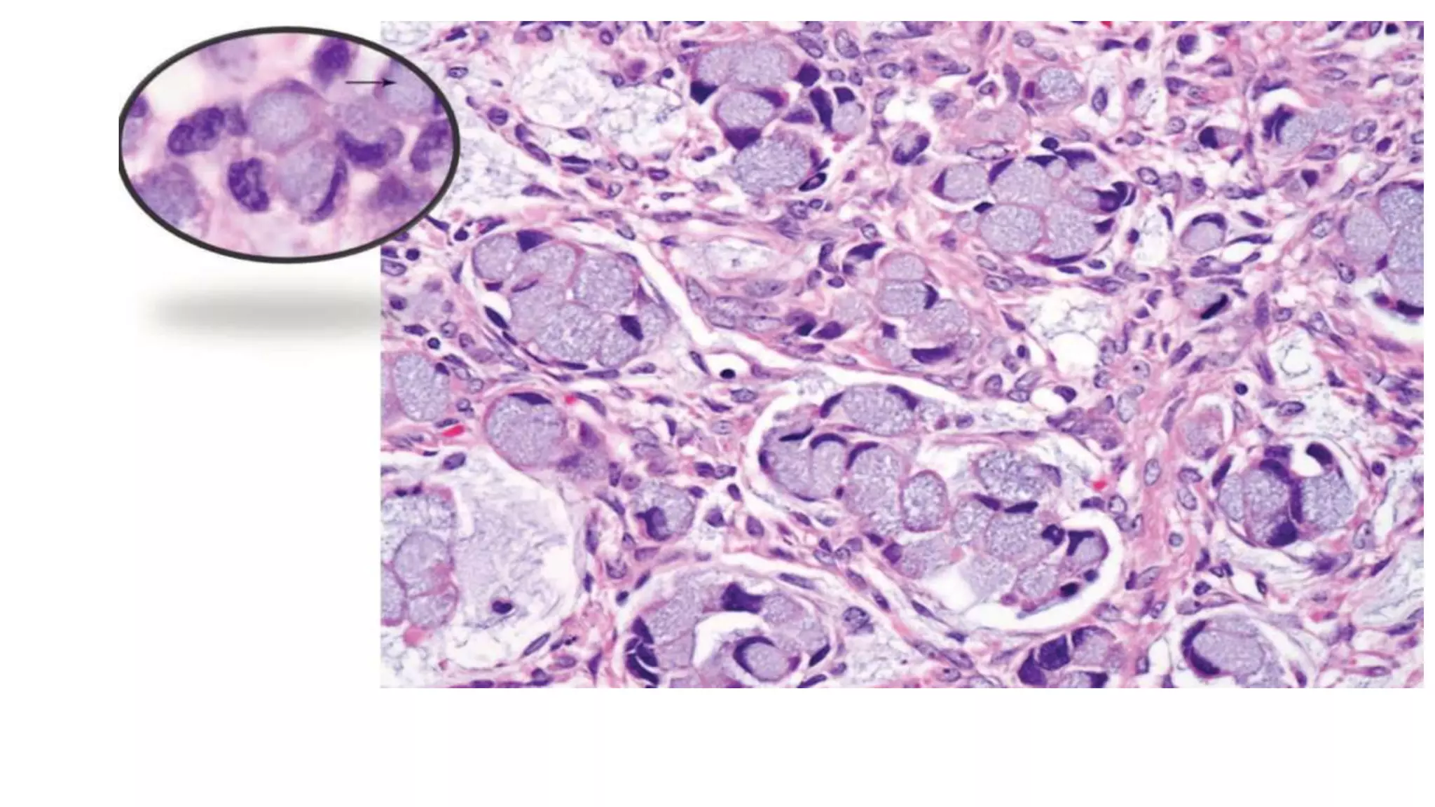 GYNAE PATH INTEGRATED.pptx