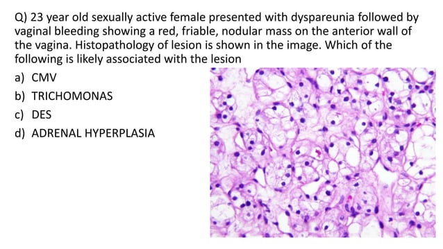 GYNAE PATH INTEGRATED.pptx