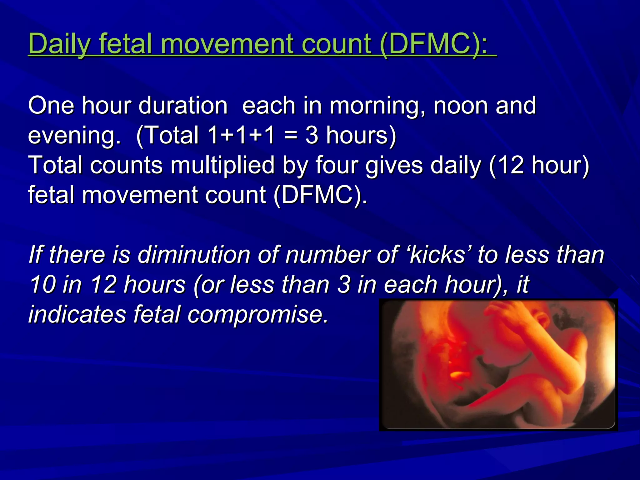 antenatal fetal surveillance | PPT